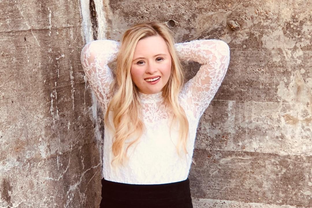 Ha la sindrome di Down e sogna di fare la modella: le dicevano che non ...