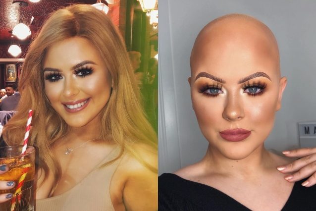 Per anni si vergogna dell'alopecia: oggi la make-up artist mostra con ...