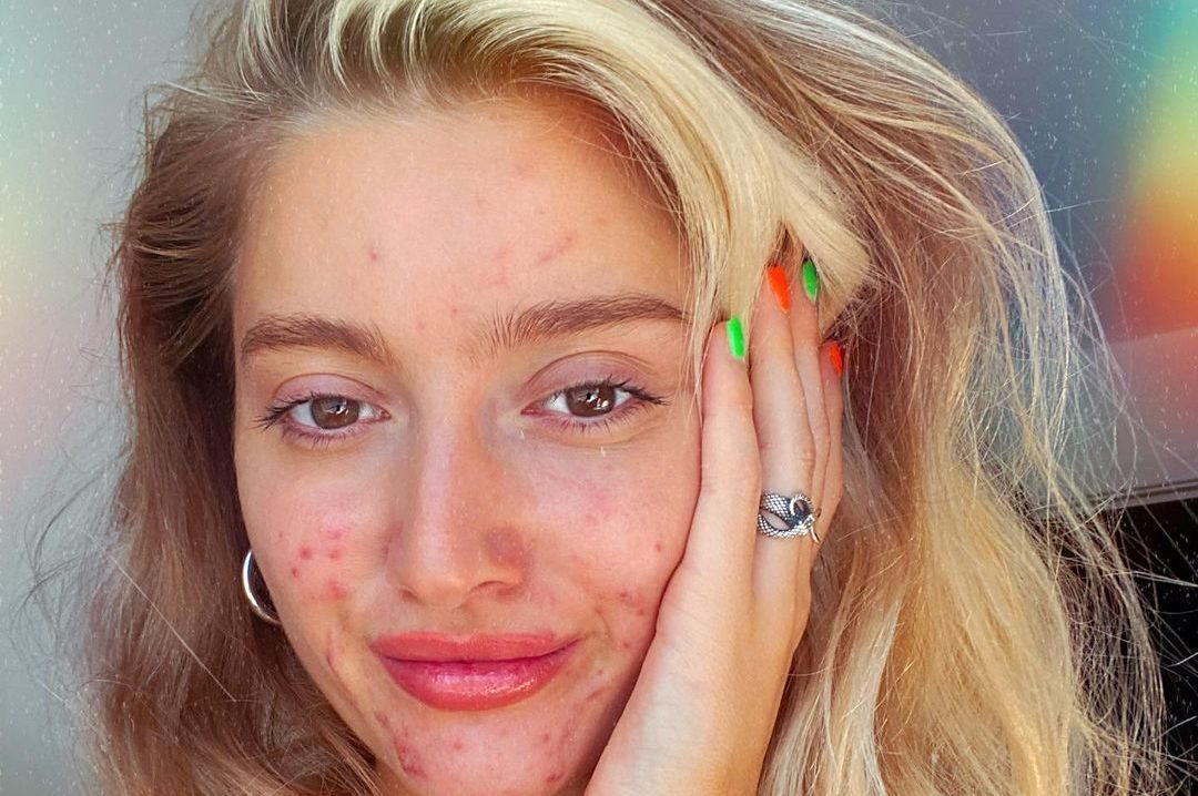 Izzie Rodgers dice addio a Photoshop: «È triste modificare i visi per ...