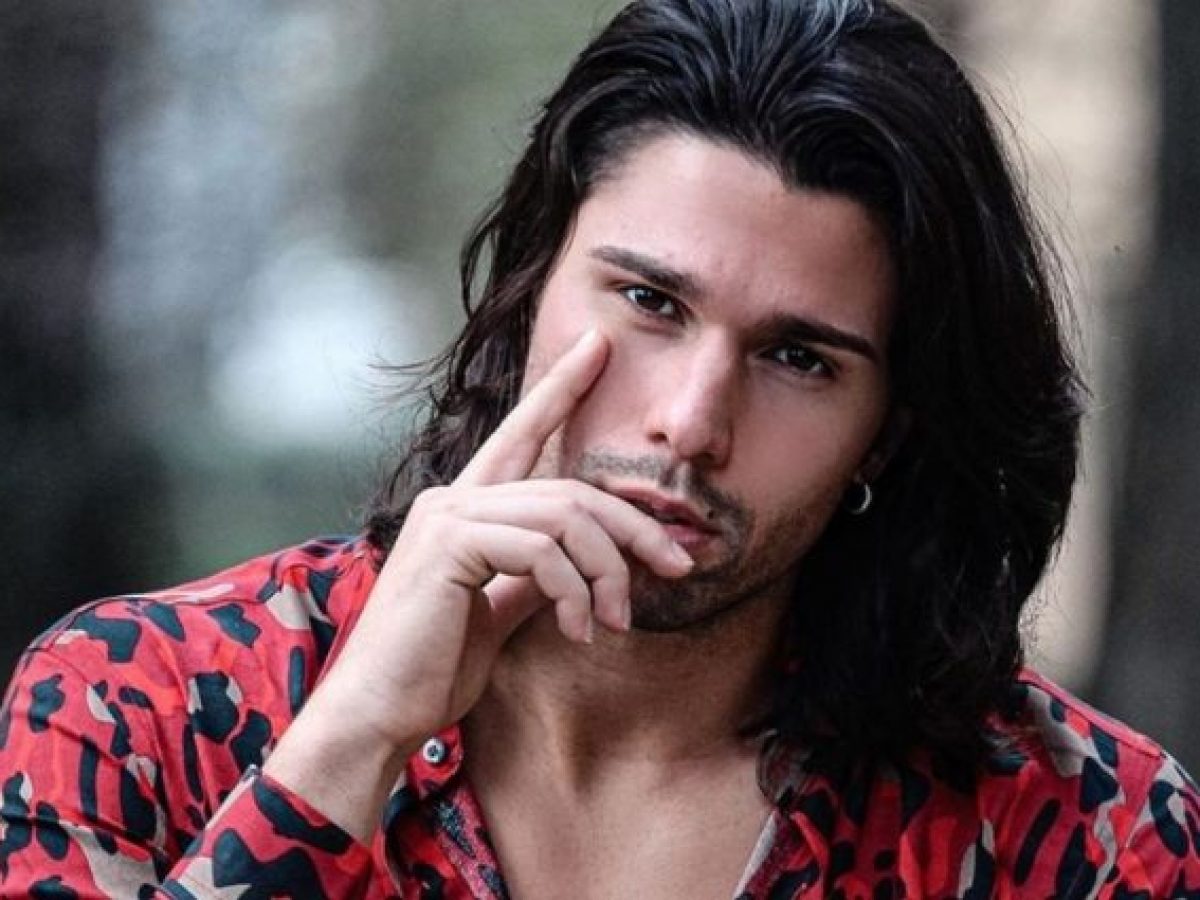 Luca Onestini e la vitiligine: A 15 anni il coach voleva mettessi i ...