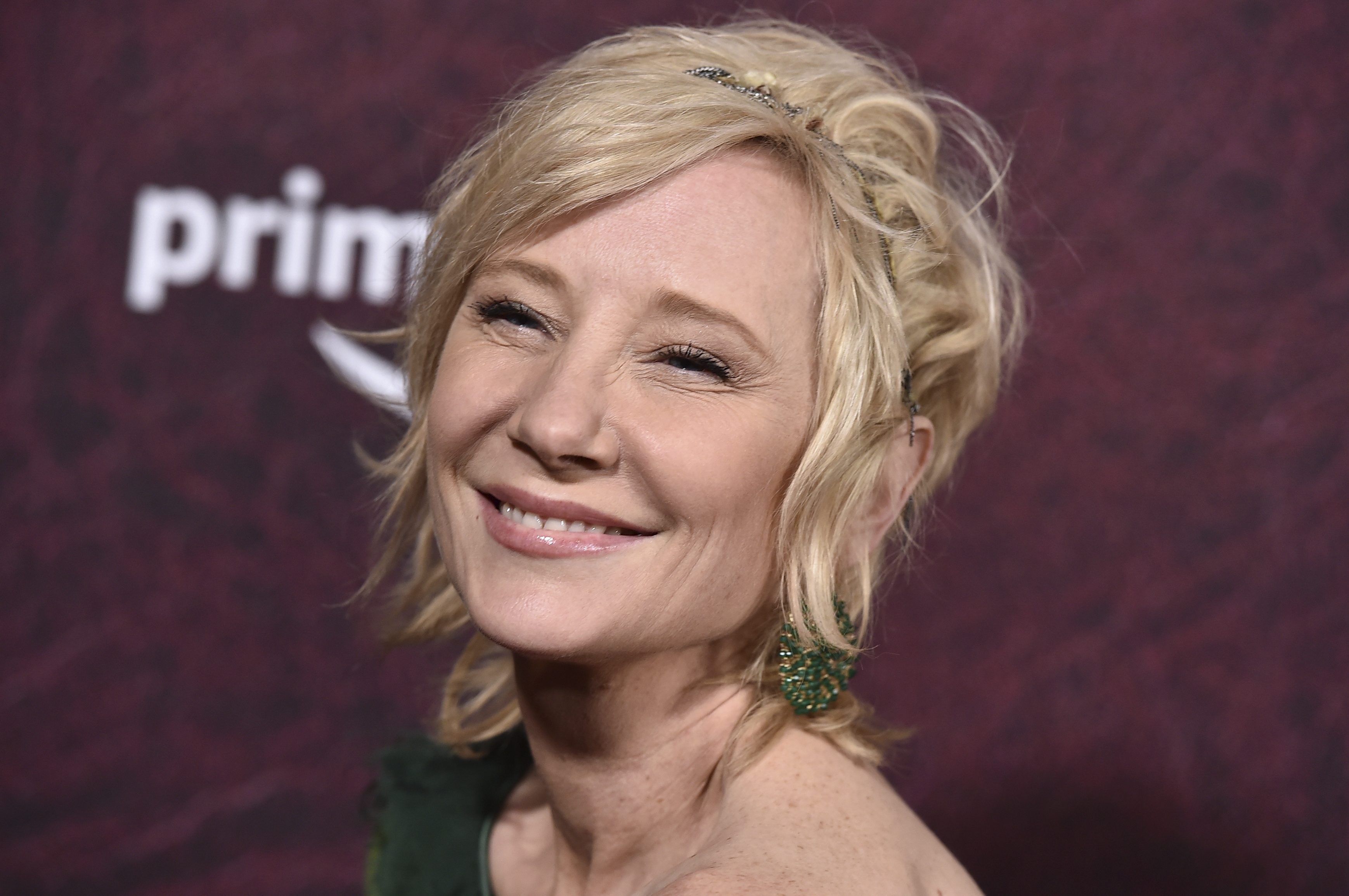 È morta Anne Heche, l'attrice aveva 53 anni ed era in coma dopo un grave incidente d'auto