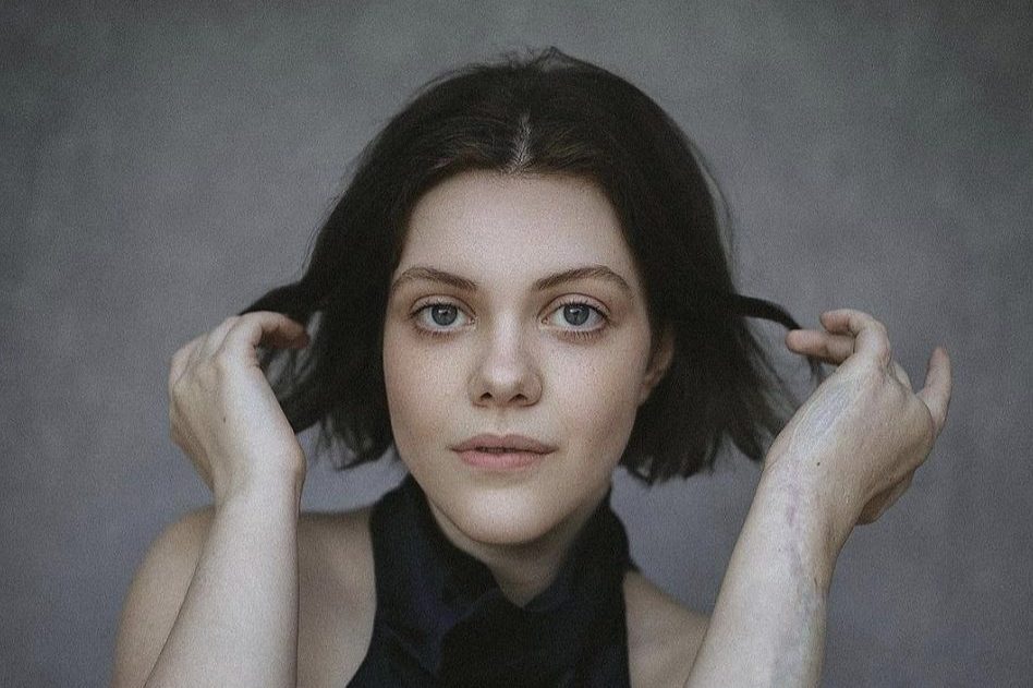 Georgie Henley di Narnia: Avevo paura che le mie cicatrici mi ...