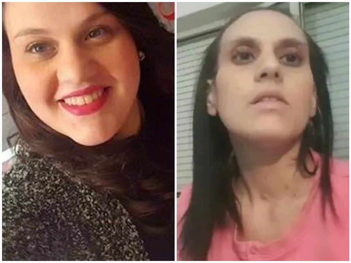 Angela Iannotta, in coma dopo operazione per dimagrire: Falsificate mie ...