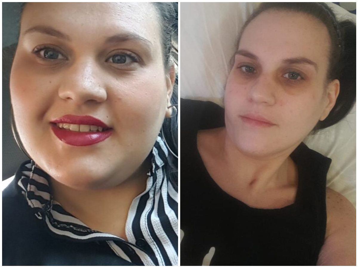 Angela Iannotta, grave dopo bypass gastrico, torna a casa dai suoi ...