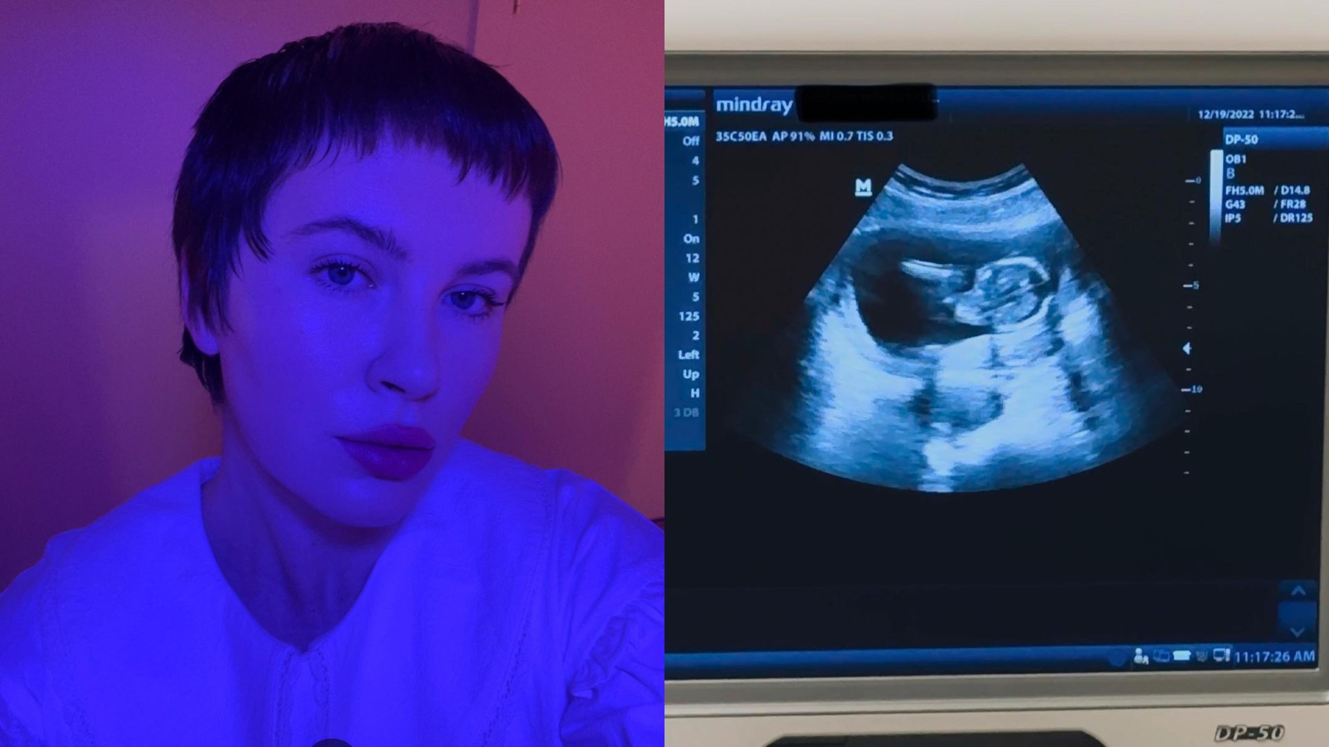 Ireland Baldwin annuncia la gravidanza con il pixie cut: Questi sono i ...