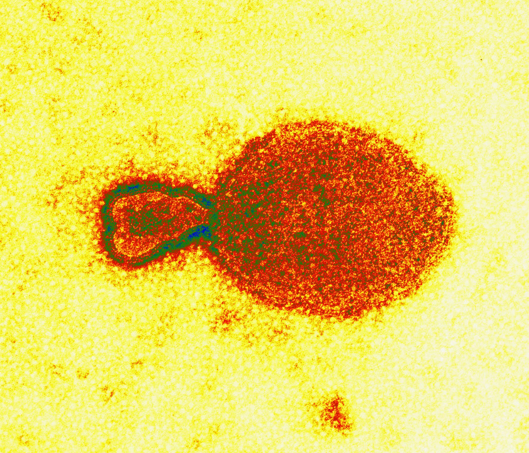 Cosa sappiamo del Langya henipavirus (LayV), il nuovo virus scoperto in ...