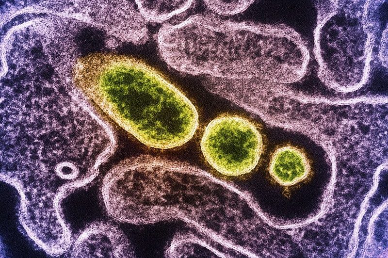 Quali sono i sintomi del Langya Henipavirus (LayV) e come si trasmette ...