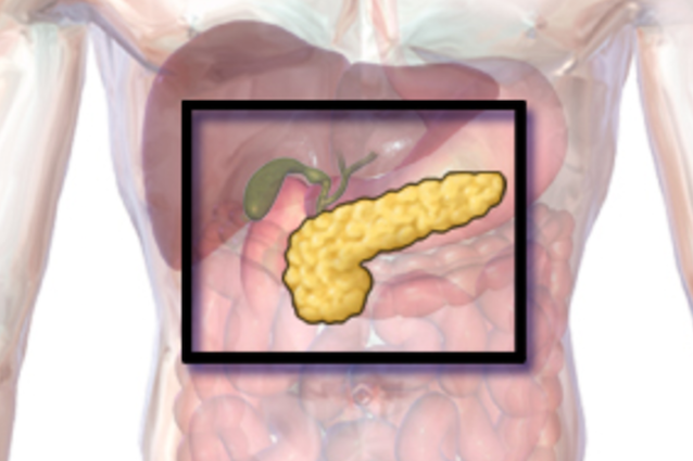 Tumore al pancreas, sintomi e cure: crescono i casi in Italia, il 18% ...