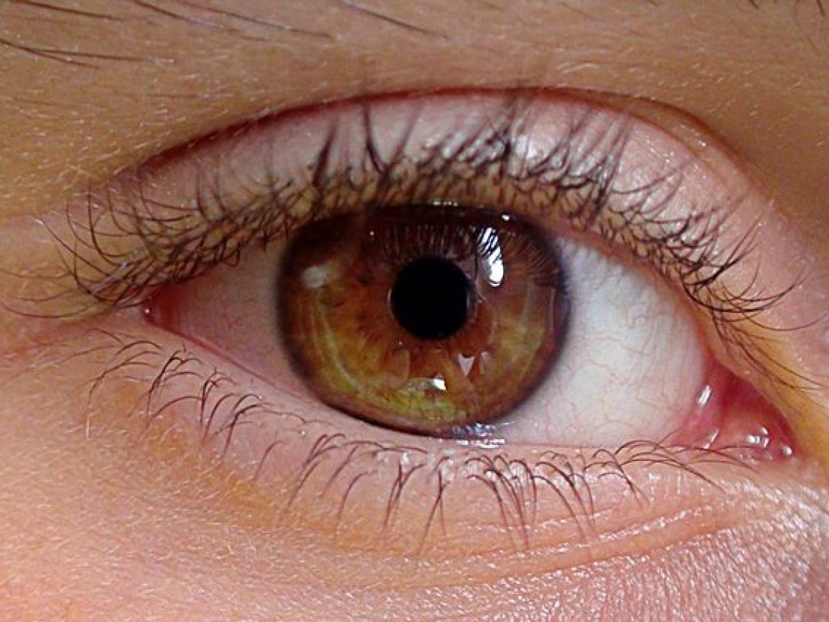 Cos'è la micropsia, il disturbo che ci fa vedere gli oggetti più ...